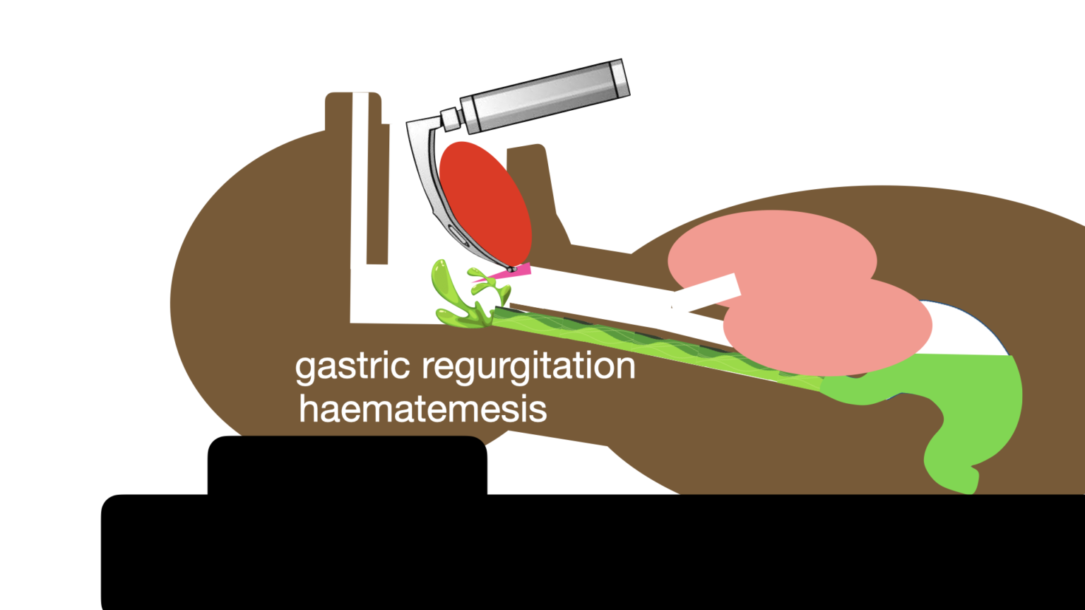 resusme | Resuscitation Medicine from Dr Cliff Reid